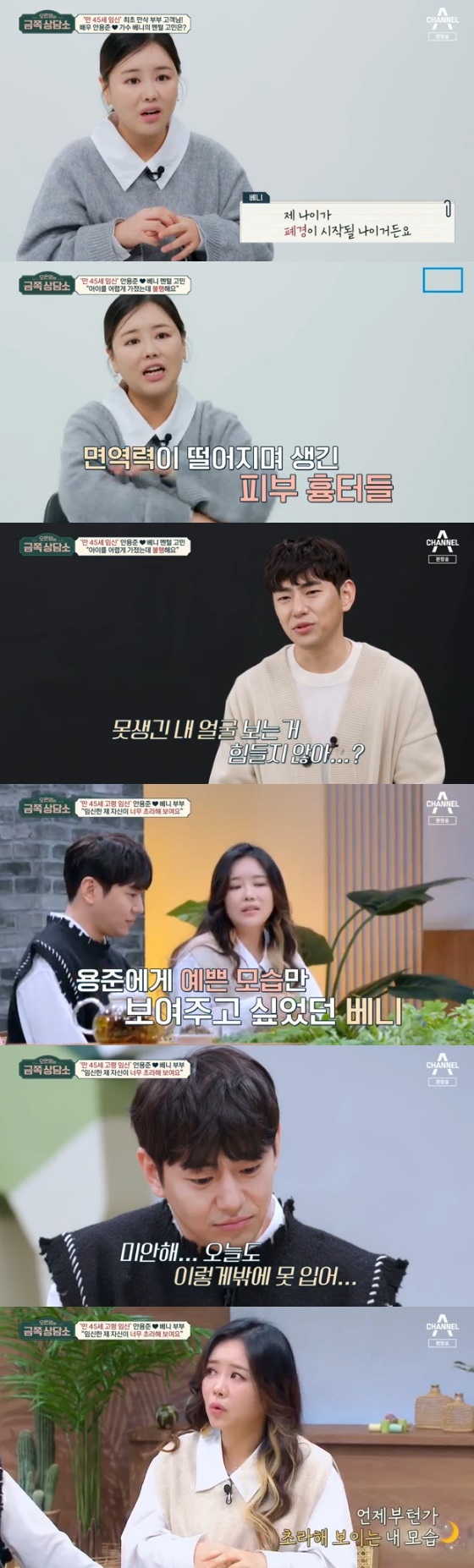 '안용준♥' 베니 "45세에 임신, 못생겨지고 온몸에 두드러기" [금쪽] [★밤TView] - 스타뉴스