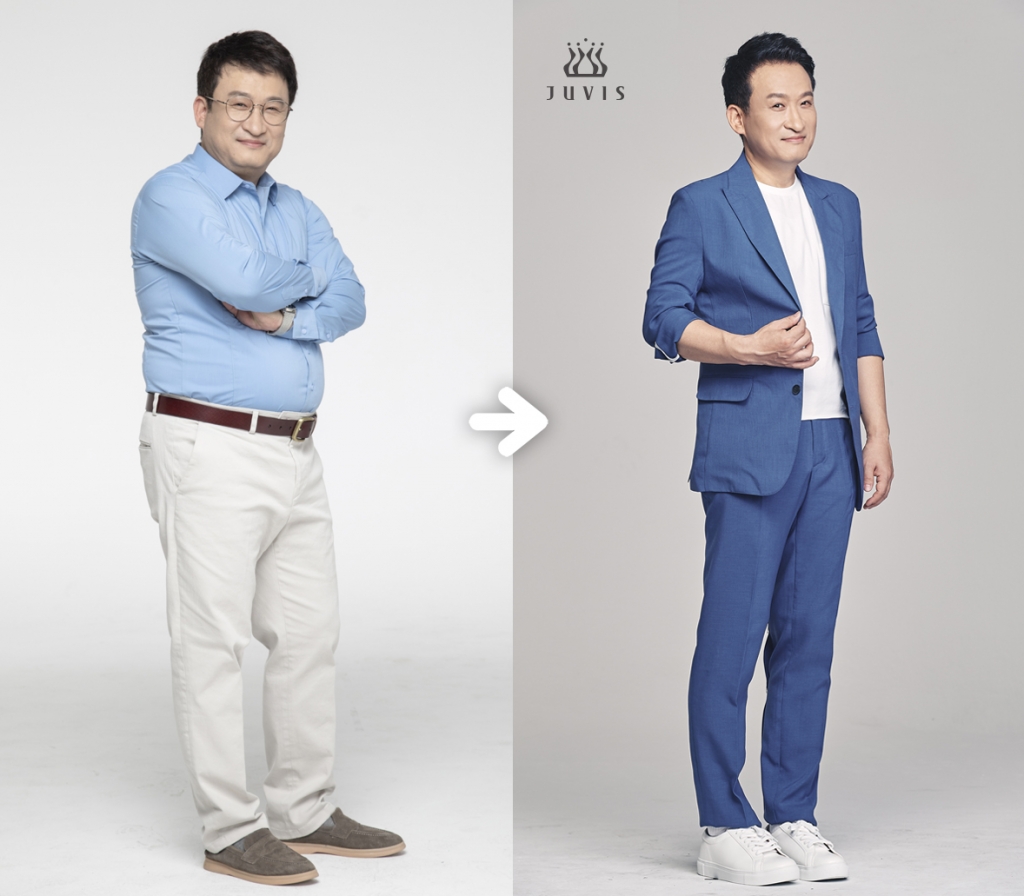 서경석, '94kg→22kg 감량' 세월 역행 반쪽 근황 | 스타뉴스