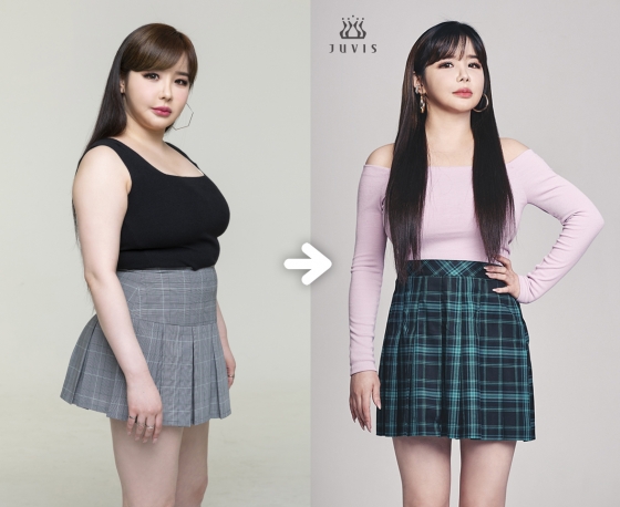 70kg였던 박봄, 다이어트 근황..약도 끊었다고? 충격 - 스타뉴스