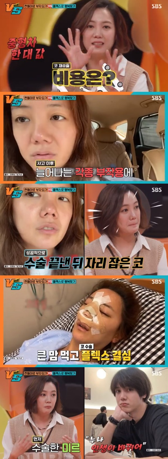 고은아 "모발 3800모 이식→미르, '인생 바뀐다'고" [강심장VS][★밤TView] | 스타뉴스