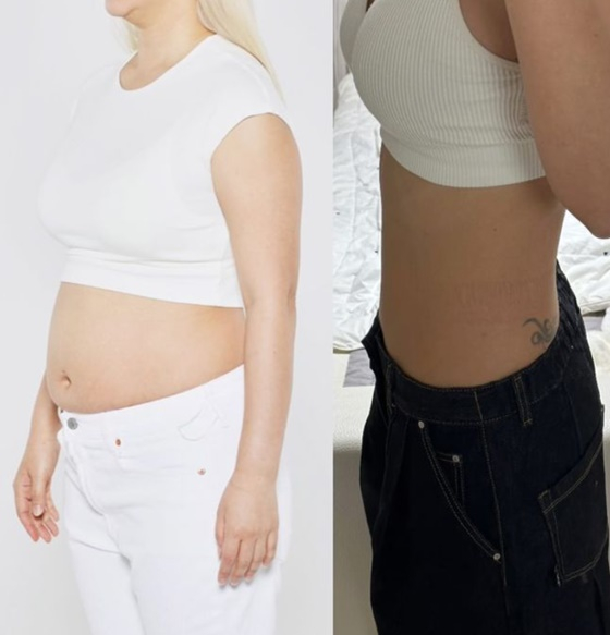 배윤정, 3개월만 13kg 감량에도 다이어트ing "한약 아직 먹어..비키니 가보자" | 스타뉴스