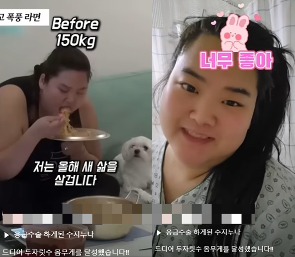 미나 시누이 150kg→99kg 이후 응급실行 충격..수술 근황 보니 - 스타뉴스