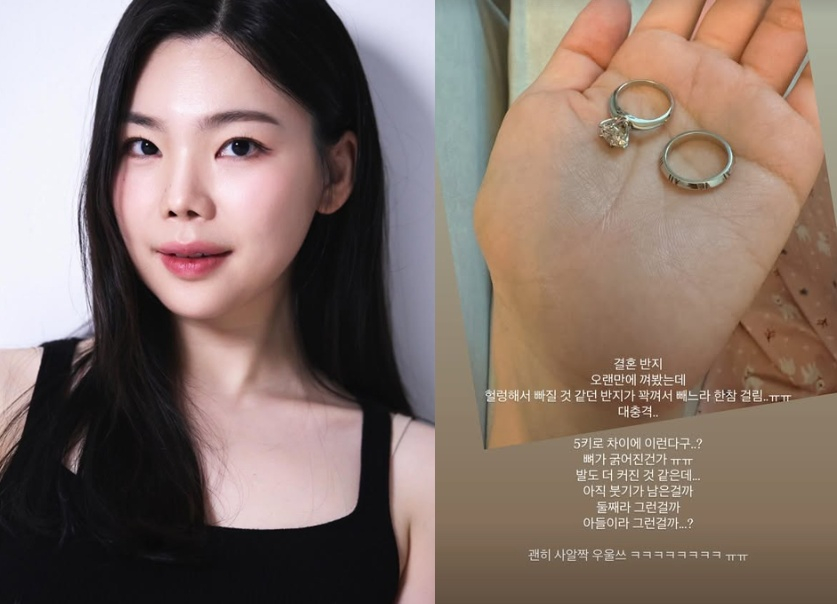 '21kg 감량' 이다은 "반지 빼느라 한참 걸림" 붓기 어떻길래 | 스타뉴스